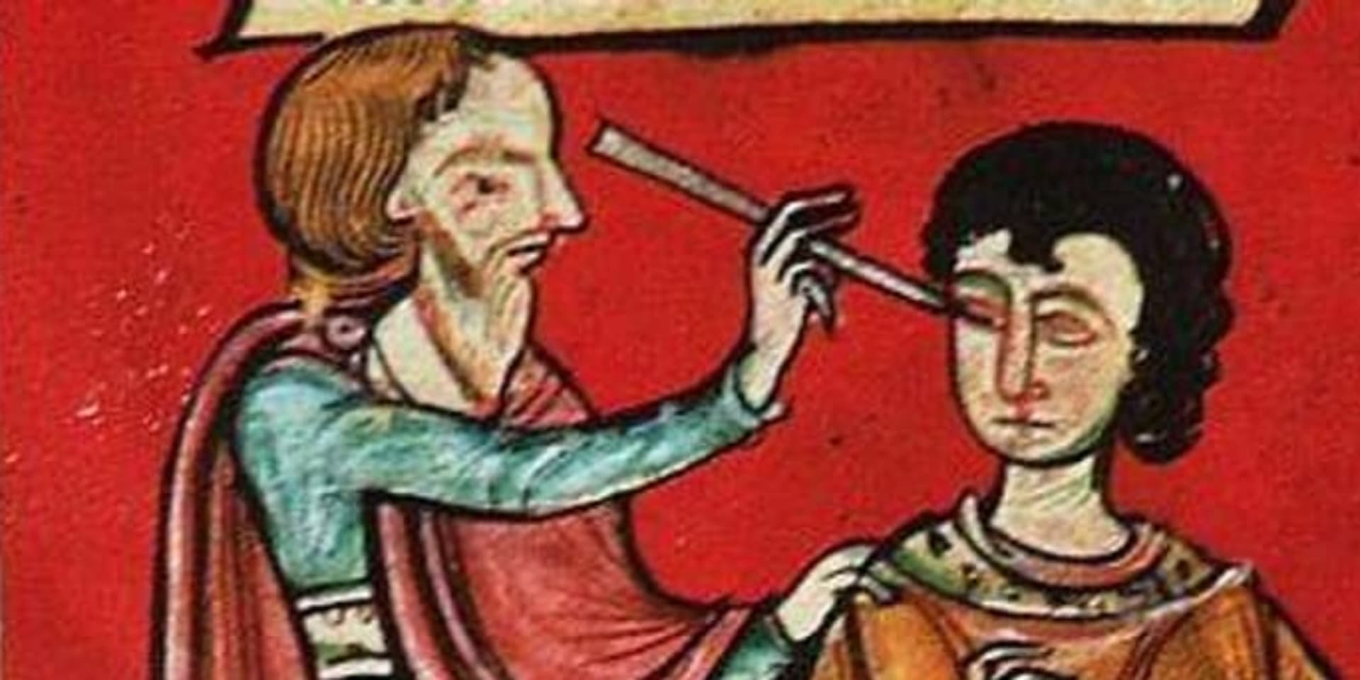 'The Extractor' Was A Painful Miracle Of Medieval Medicine That Saved A ...