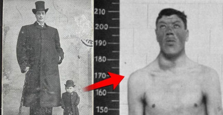The Bizarre Saga of Adam Rainer, the Only Person Ever To Be A Dwarf And ...