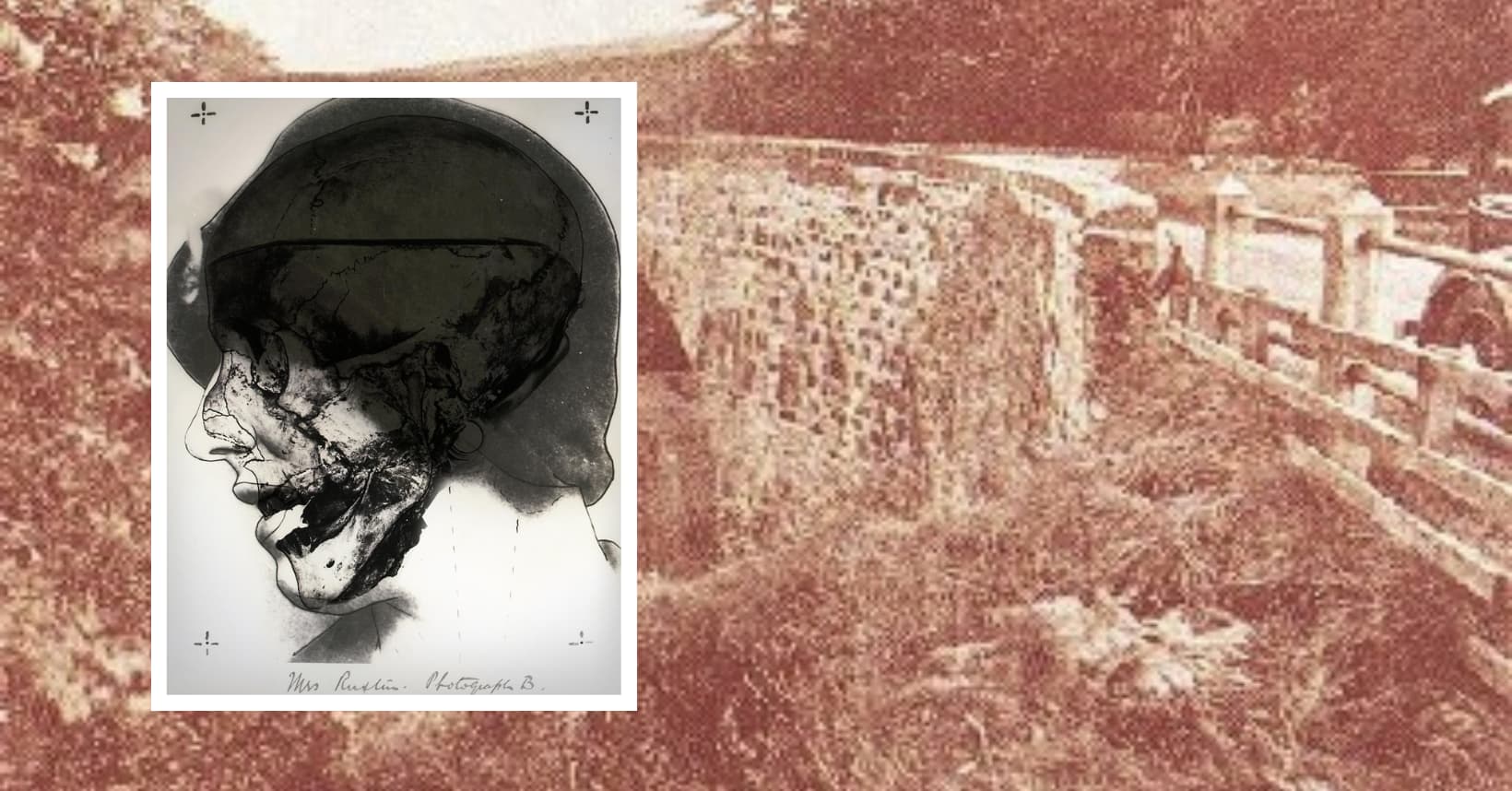 The True Story Of Buck Ruxton And The 'Jigsaw Murders'