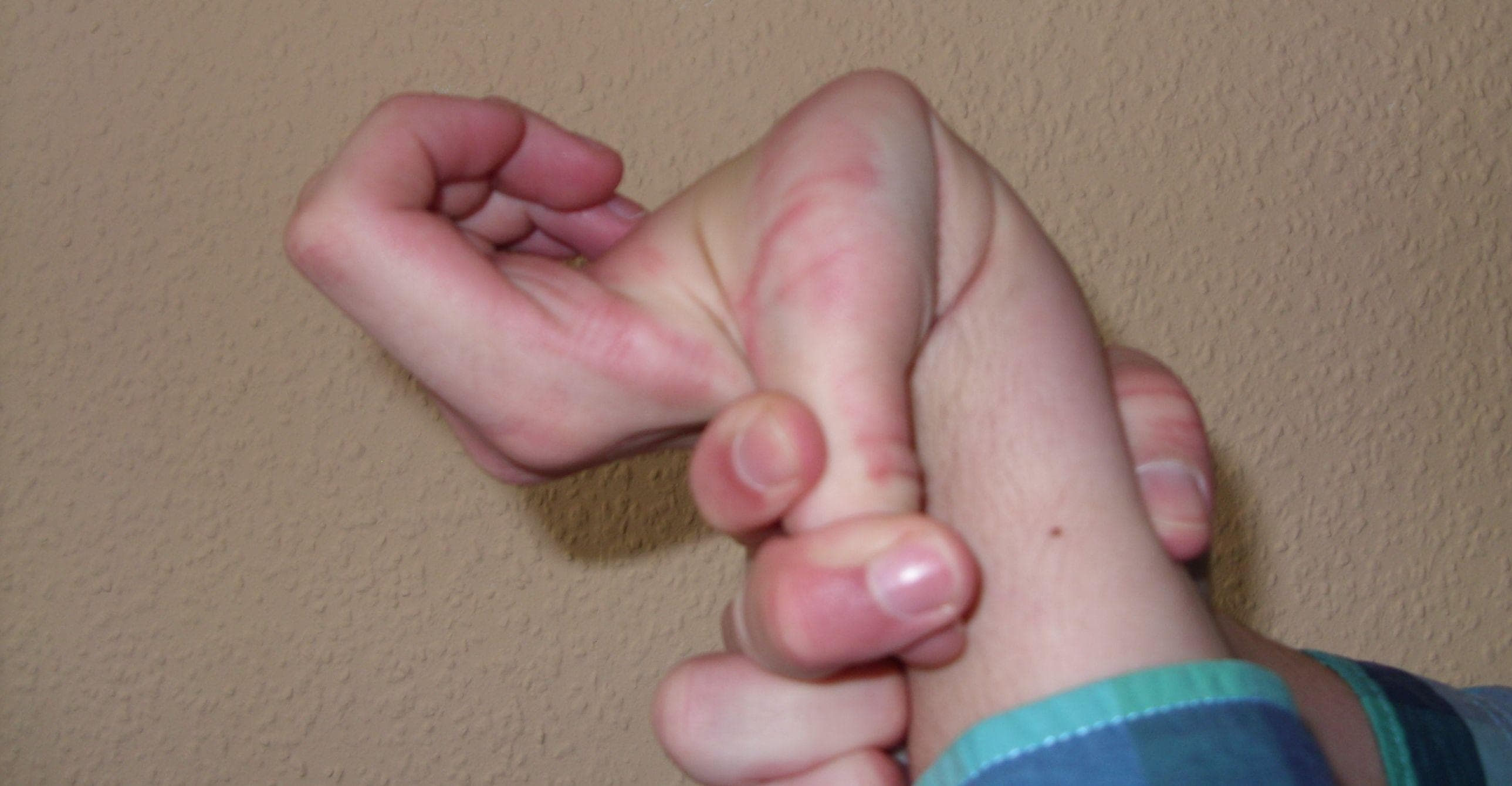 Unsettling Double-Jointed Abilities That Will Tie Your Stomach In Knots