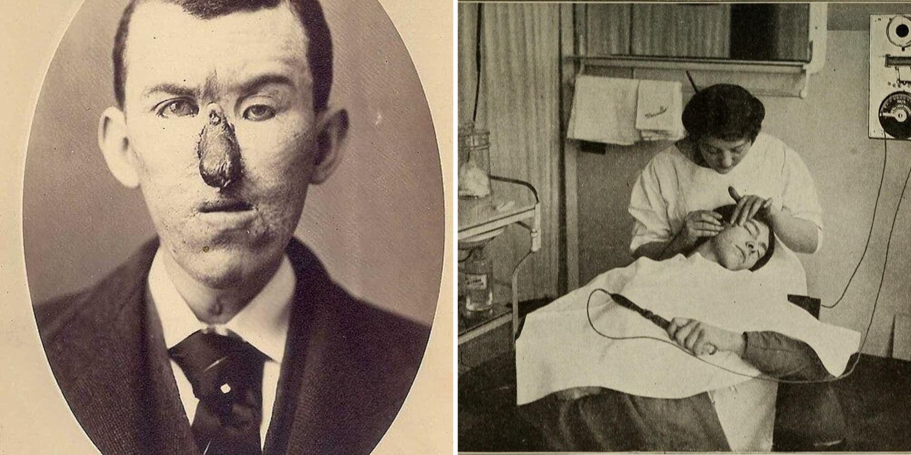 Early Historical Versions Of Modern Cosmetic Surgeries