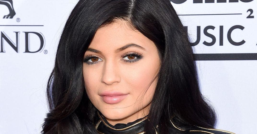 50+ Celebrities With Lip Fillers