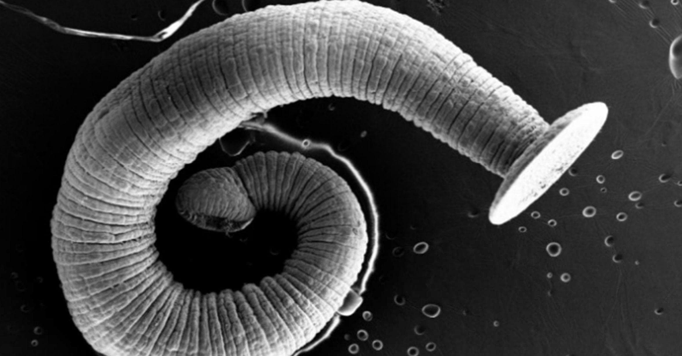 Here Are All The Terrible Things That Happen To Your Body When You Eat ...