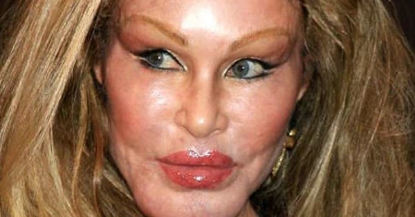 Addicted to Plastic Surgery: 12 Biggest Plastic Surgery Addicts