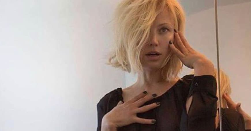 8 Celebrities With Clubbed Thumbs