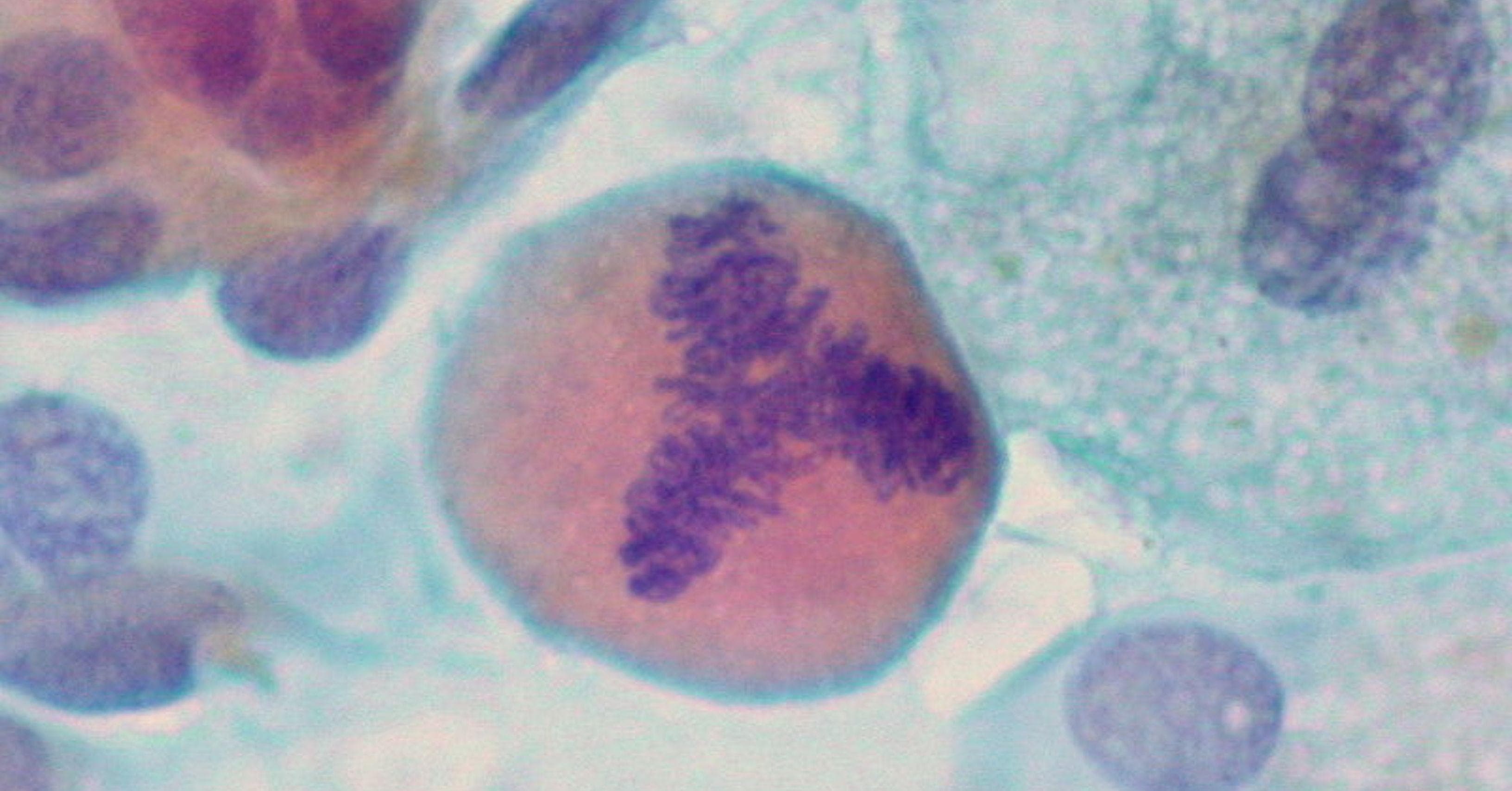 Scary Cyst and Tumor Pictures You Should Never Google