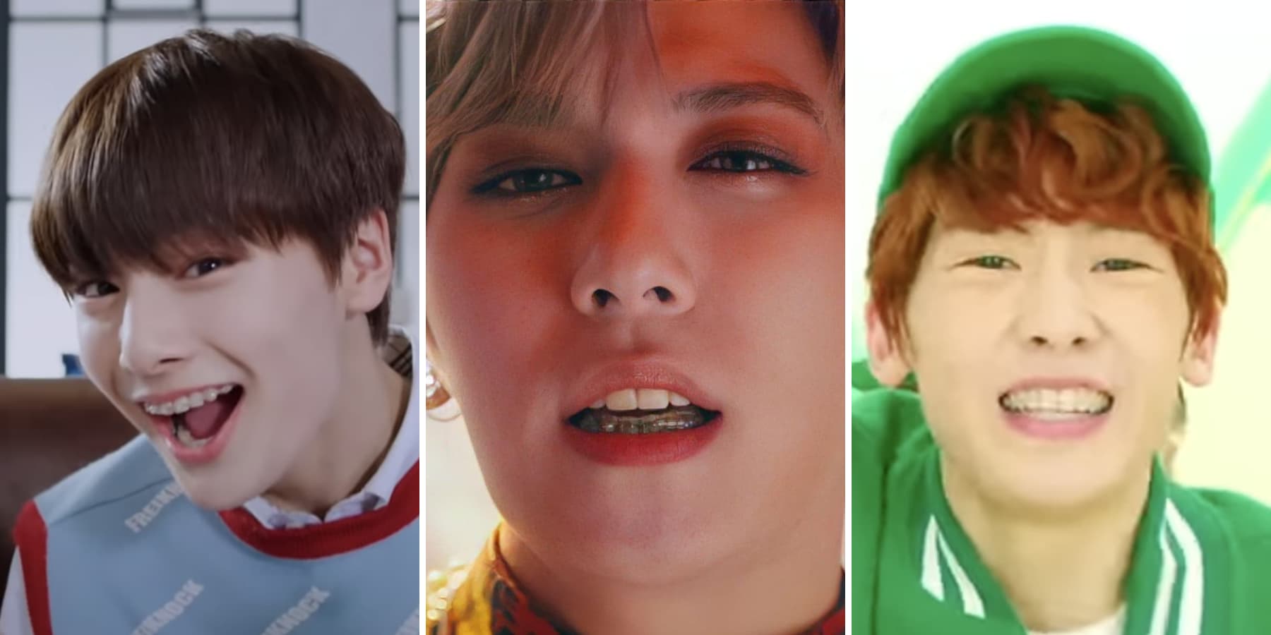 The 15 Best K-Pop Idols With Braces, Ranked By Fans