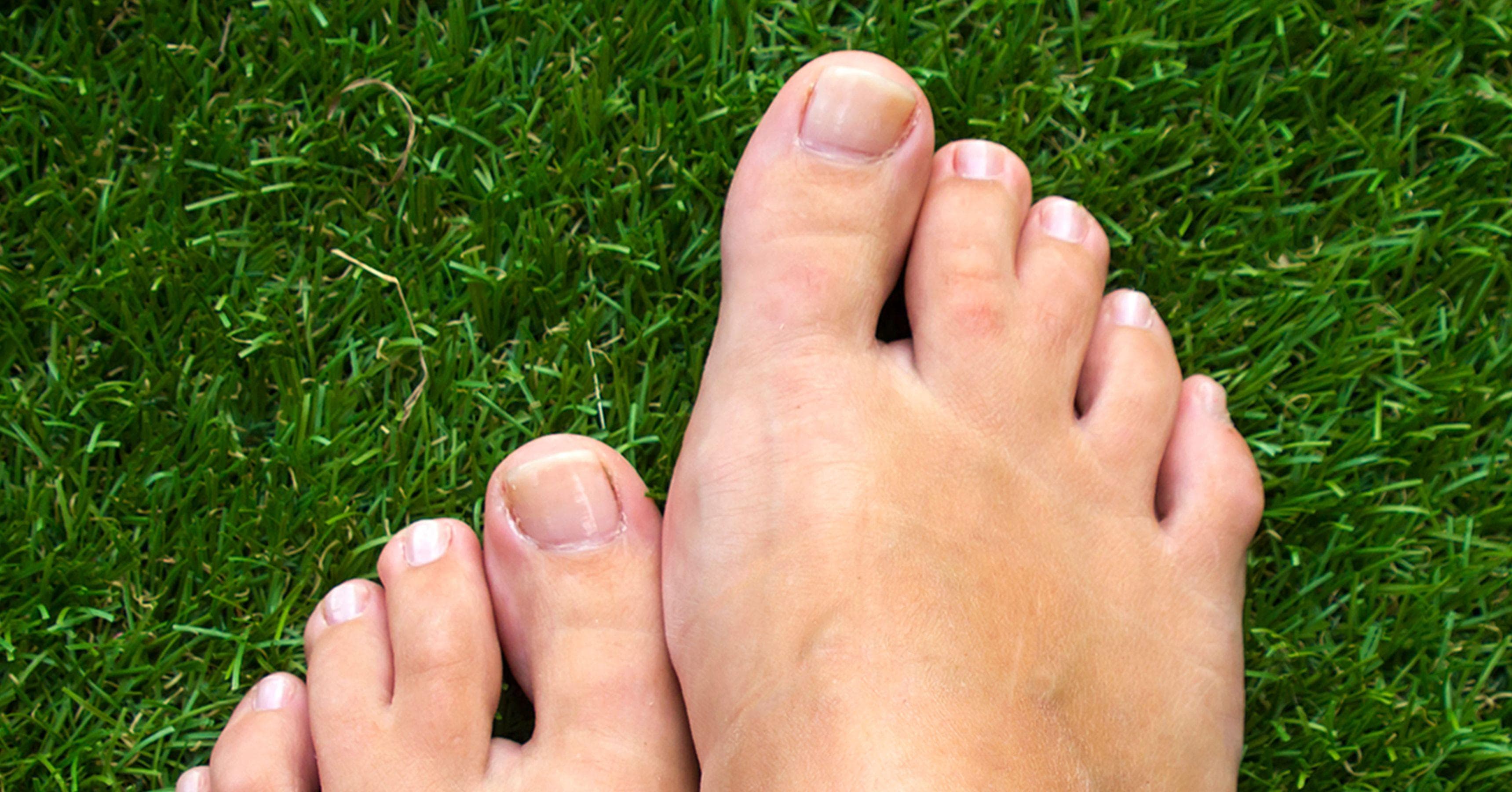 10 Celebrities Who Have Webbed Feet and Toes