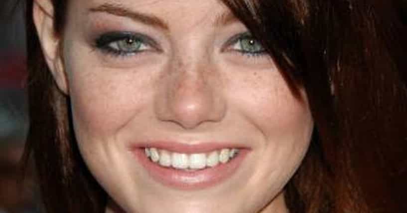 Hottest Women with Freckles | Beautiful Sun-Kissed Celebrities Hottest Women with Freckles | Beautiful Sun-Kissed Celebrities