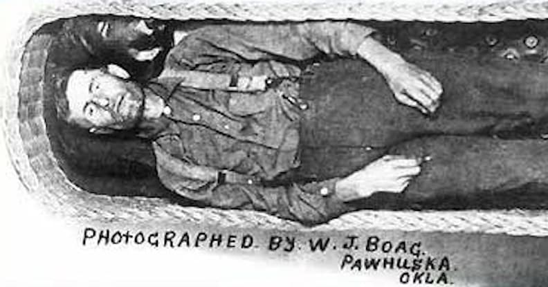 The Strange Story Of Outlaw Elmer McCurdy