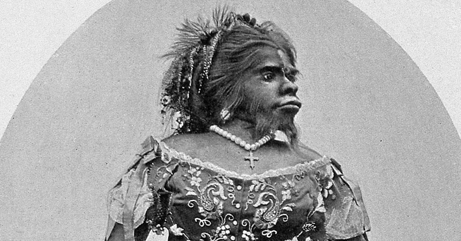 The Tragic Life And Death Of Julia Pastrana, Known As 'The Ugliest ...