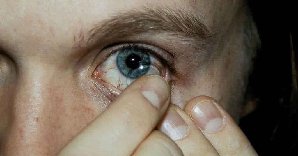 Contact Lens Horror Stories | Worst Things That Can Happen with Contacts