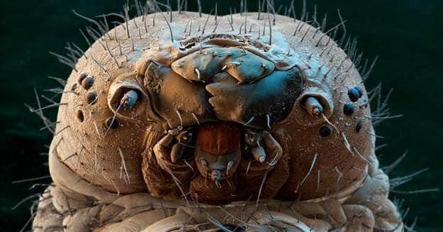 Creepy Images of Micro-Organisms That Are on You Right Now