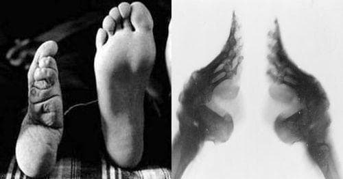 Crazy Things You Didn't Know about Ancient Chinese Foot Binding