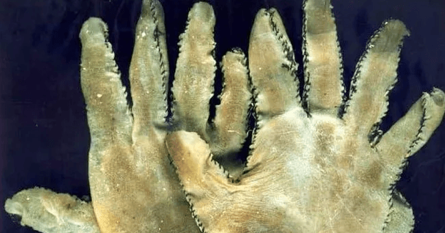 10 Random Objects That Were Actually Made Out of Human Skin