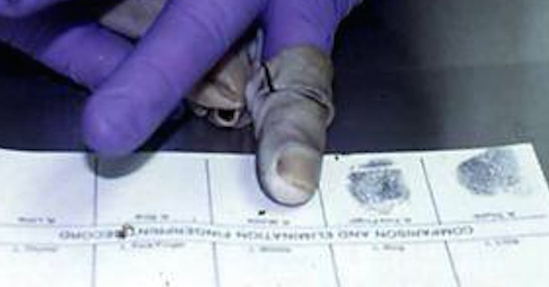 A Gruesome Step by Step Walkthrough of an Autopsy