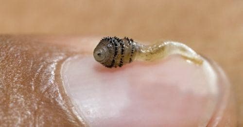 11 Insects That Will Lay Their Eggs Inside You