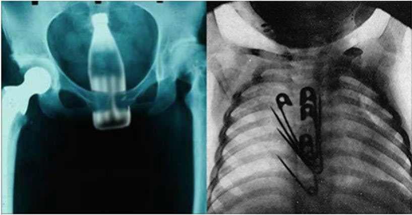 Most Embarrassing Medical Emergencies