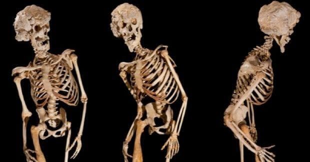 12 Heartbreaking Facts About Joseph Merrick, The Elephant Man