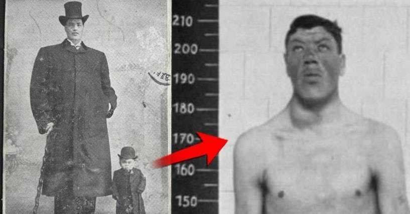 The Bizarre Saga of Adam Rainer, the Only Person Ever To Be A Dwarf And ...