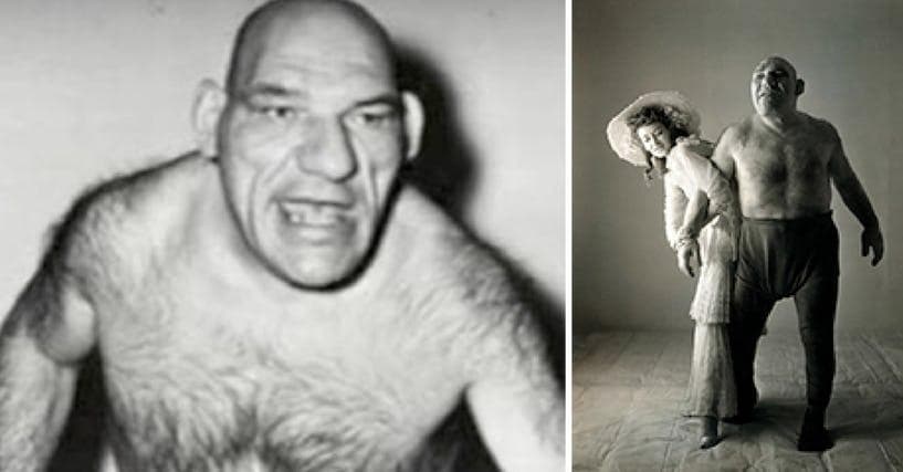 These Photographs Show The Tragic Story Of The Kind-Hearted Real Life Shrek