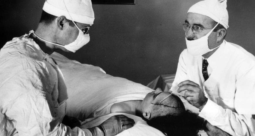 14 Disturbing Facts About The History Of The Lobotomy