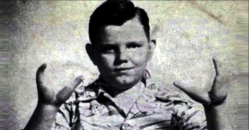 Meet Grady Stiles, The Murderous Lobster Boy Who Killed His Daughter's ...