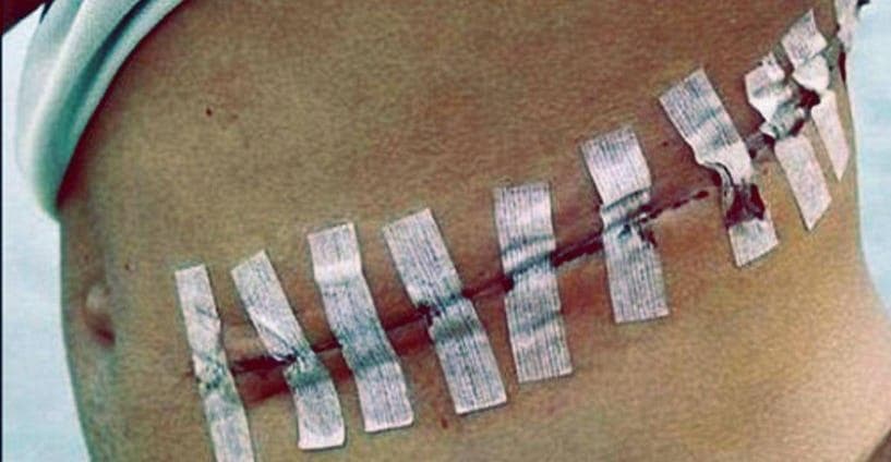 Here's What All Your Organs And Parts Are Worth On The Black Market