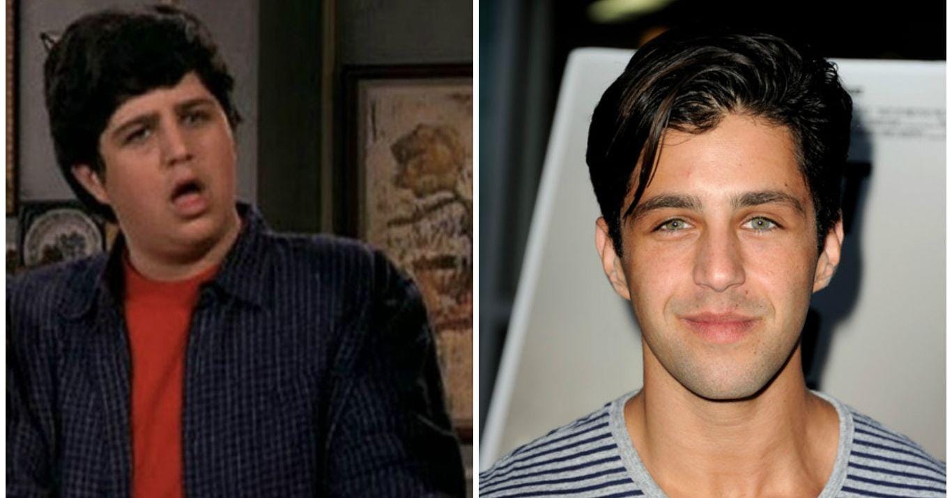 12 Times Puberty Was Really Good To Nerdy Child Actors