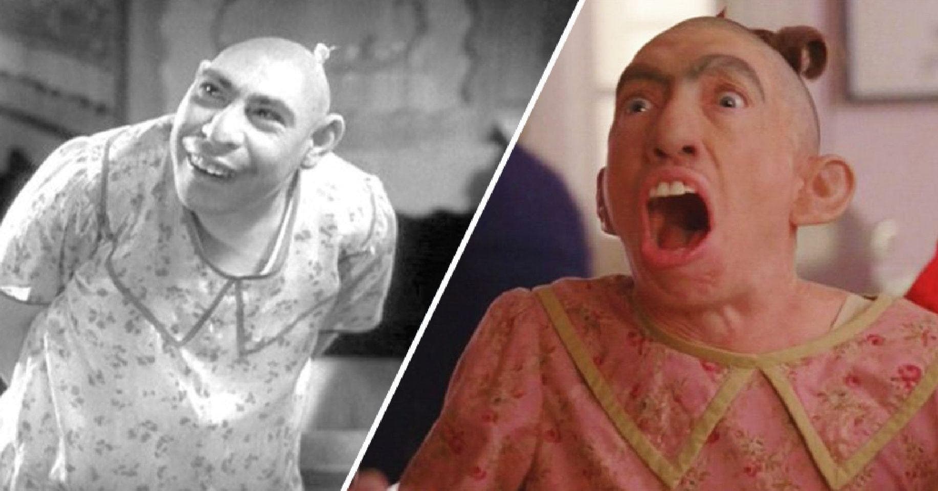 The Strange Life And Times Of Schlitzie, The "Pinhead" From Freaks