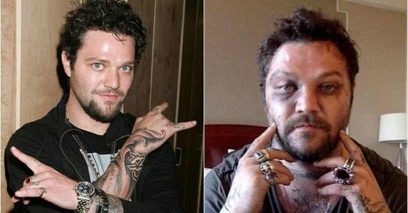 All The Members Of Jackass: Where Are They Now?