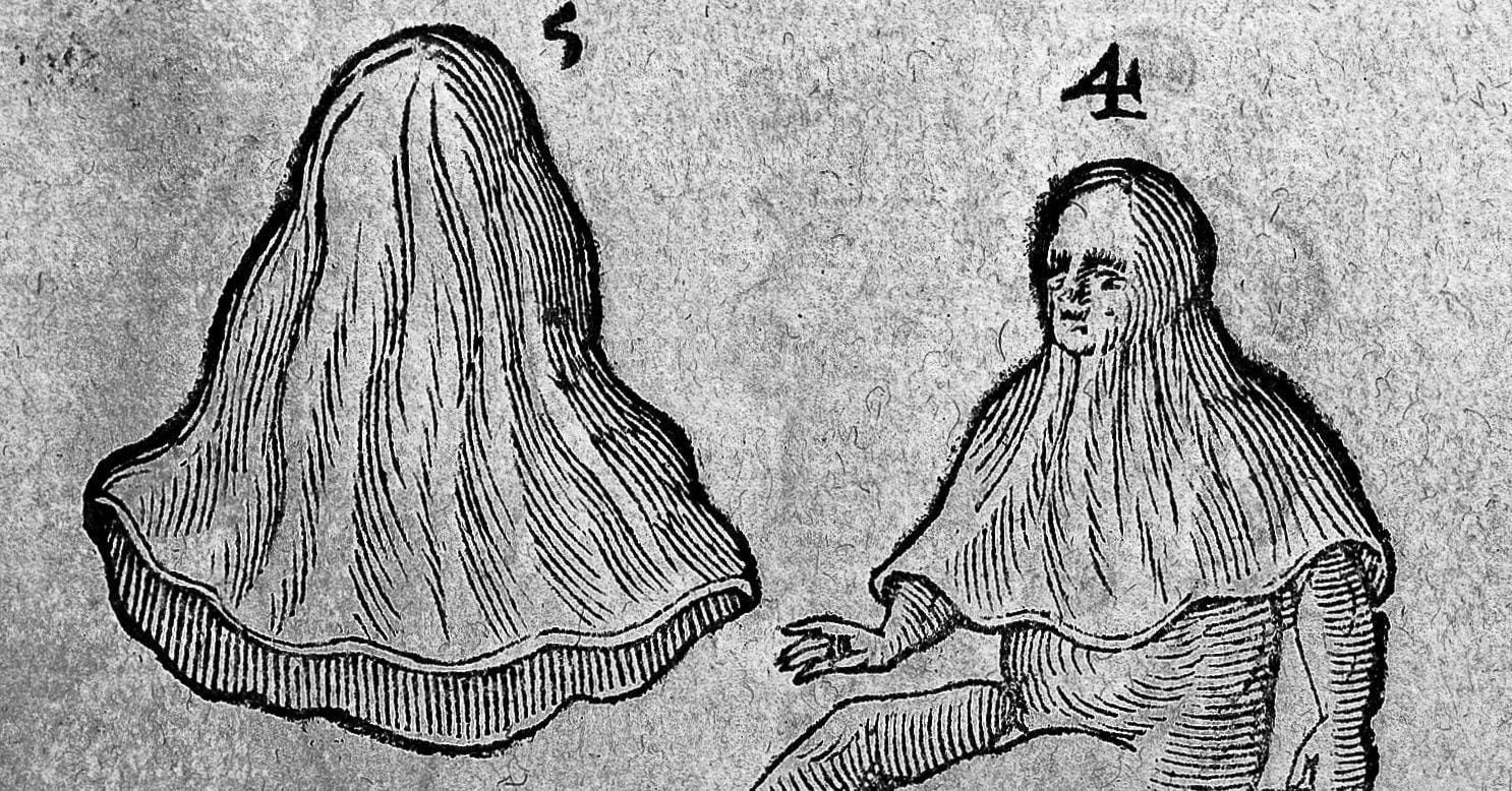 Historical Superstitions About The Caul, The Amniotic Membrane That Has ...