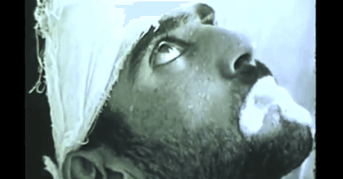 Here's What Happens to Your Body When You Get Rabies