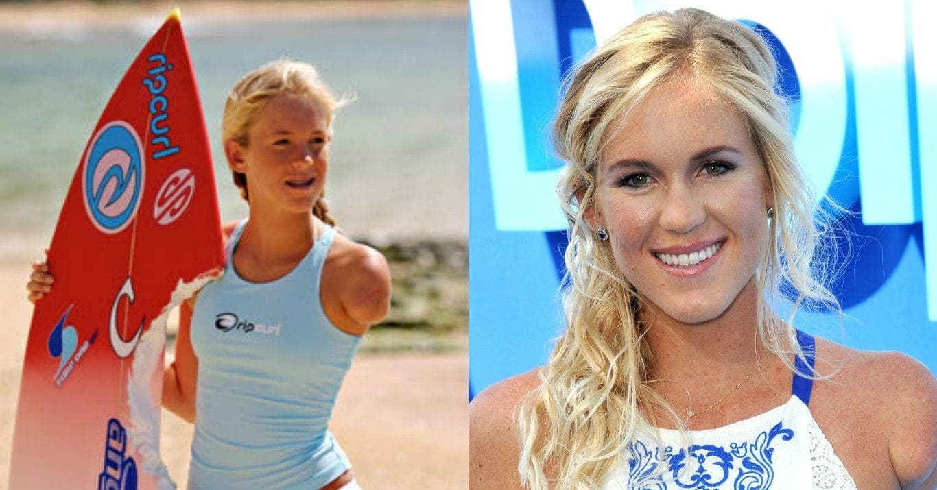 Bethany Hamilton Had Her Arm Bit Off By A Shark, But What Is She Up To ...