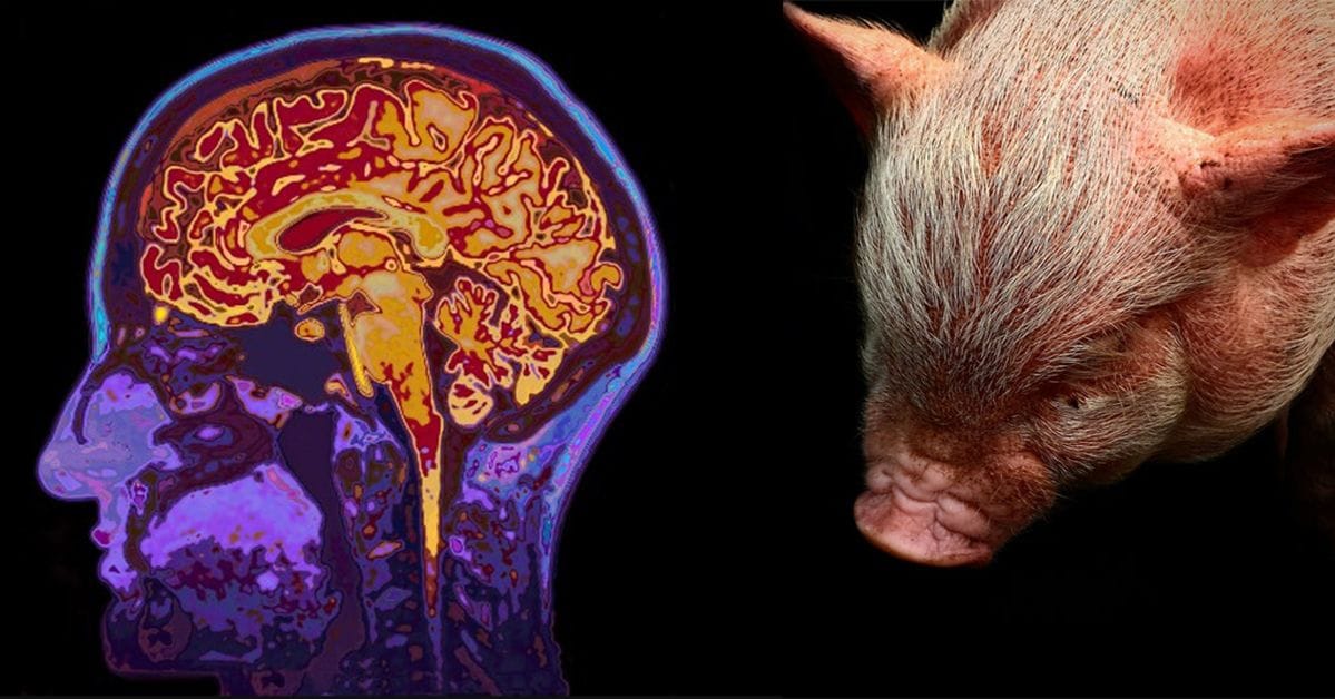 “Brain In A Bucket” Is A Creepy New Study That Could Lead To A “Living ...