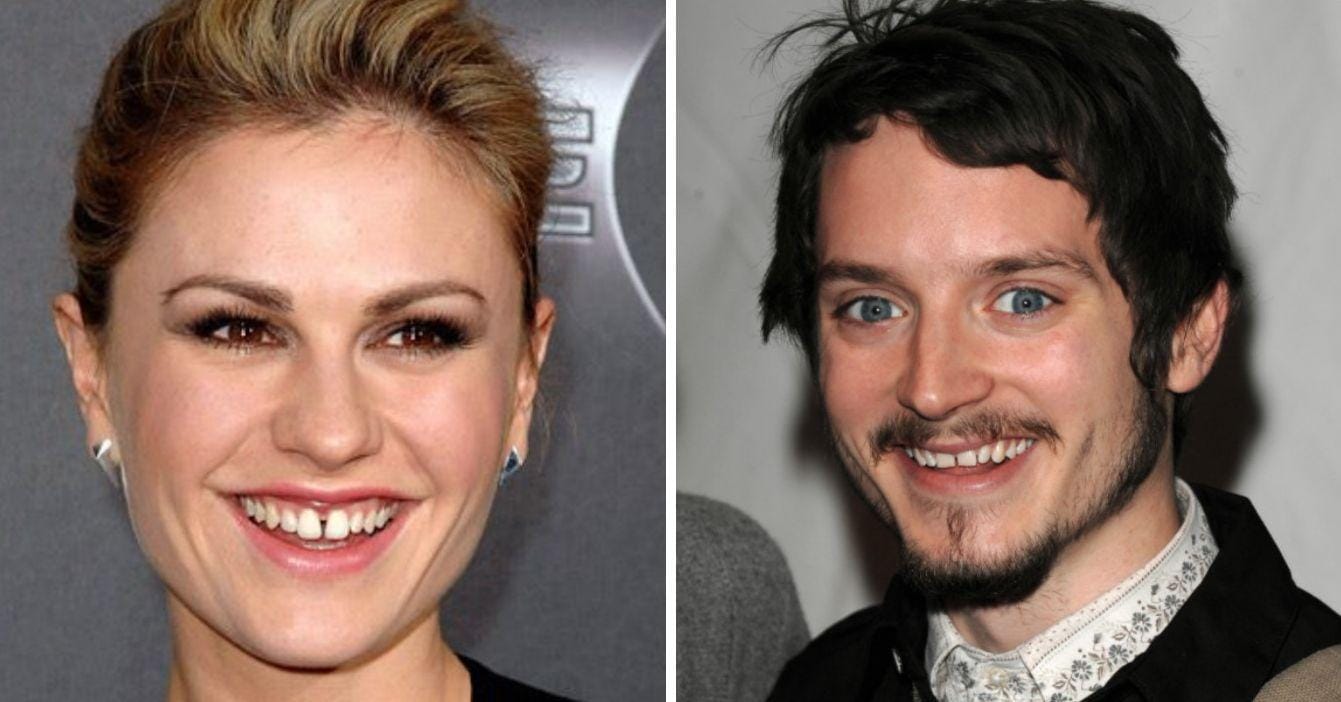 Celebrities With Gap Teeth Famous People Who Are Gap Toothed