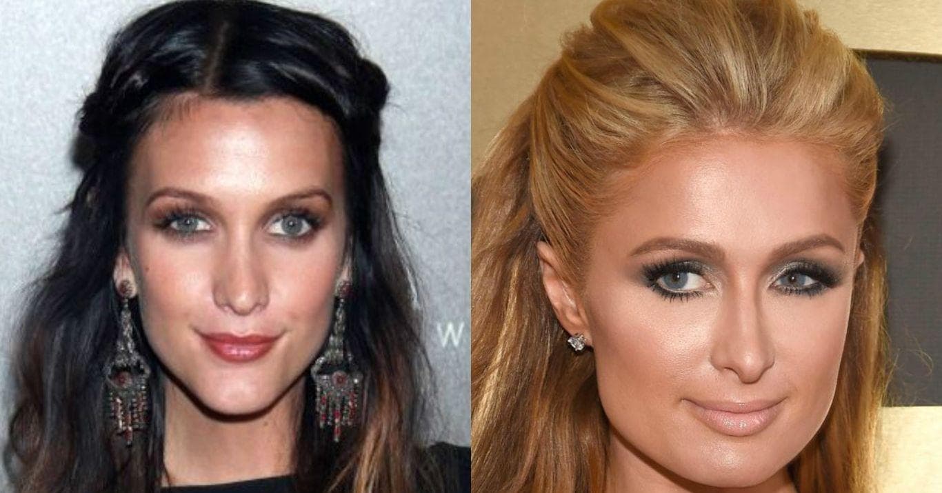 Celebrities with Strabismus | List of Famous People with Lazy Eyes