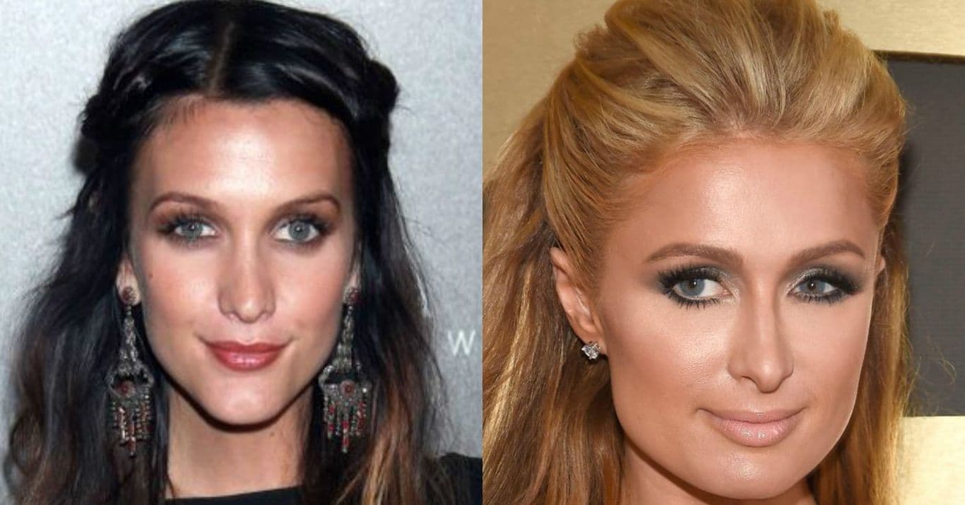 Celebrities with Strabismus | List of Famous People with Lazy Eyes