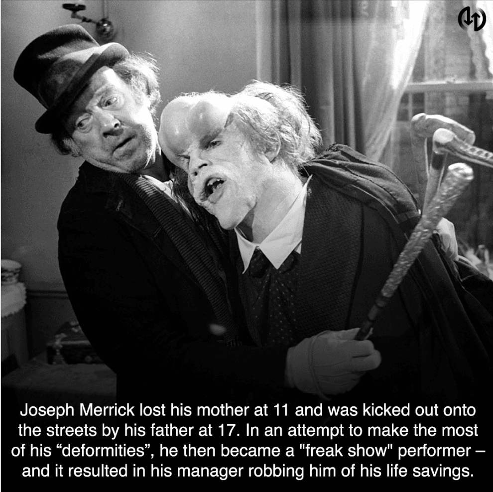 Joseph Merrick Quotes Joseph Merrick Quotes