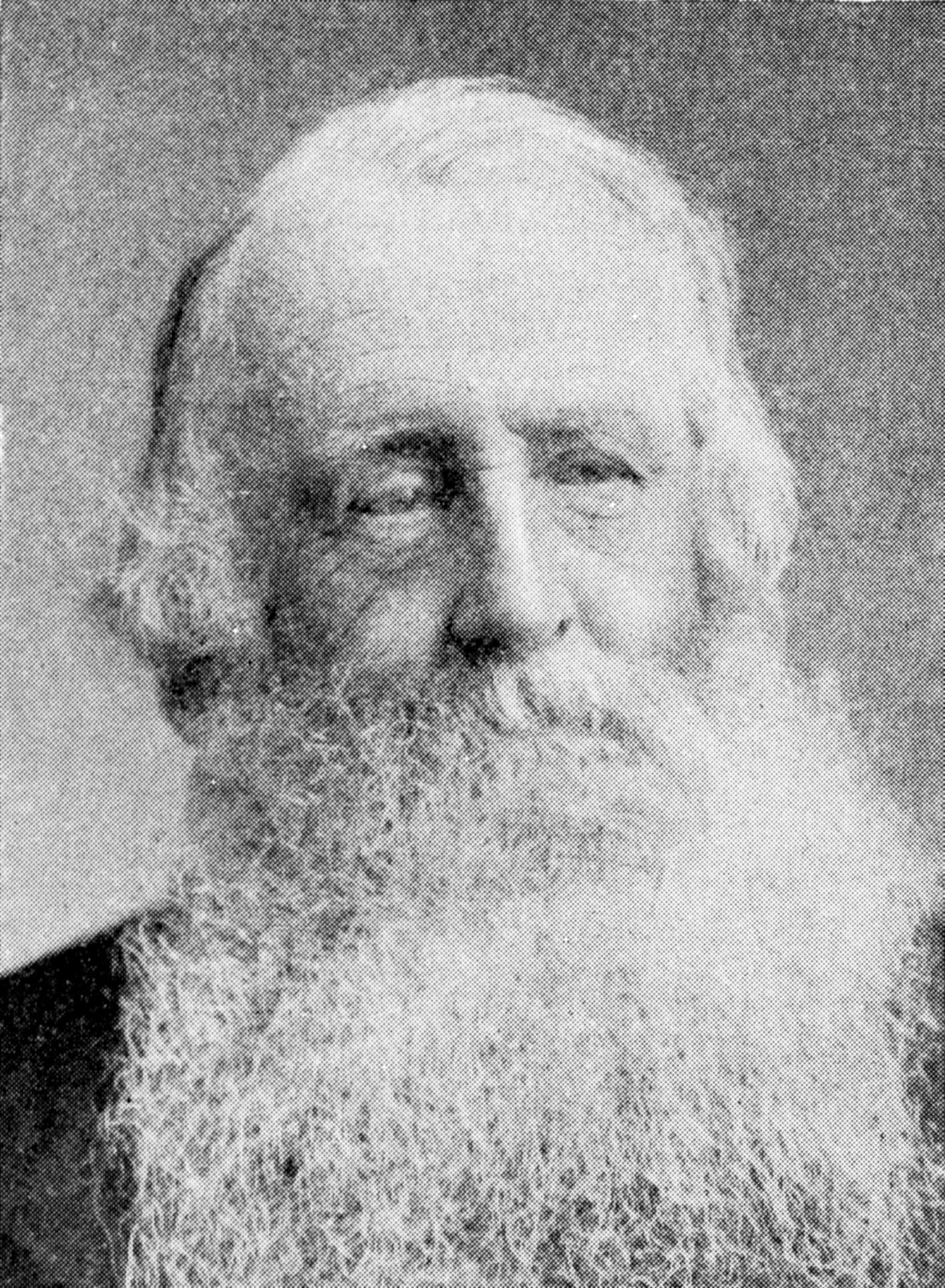 Famous People Who Died of Smallpox | List of Celebrity Smallpox Deaths