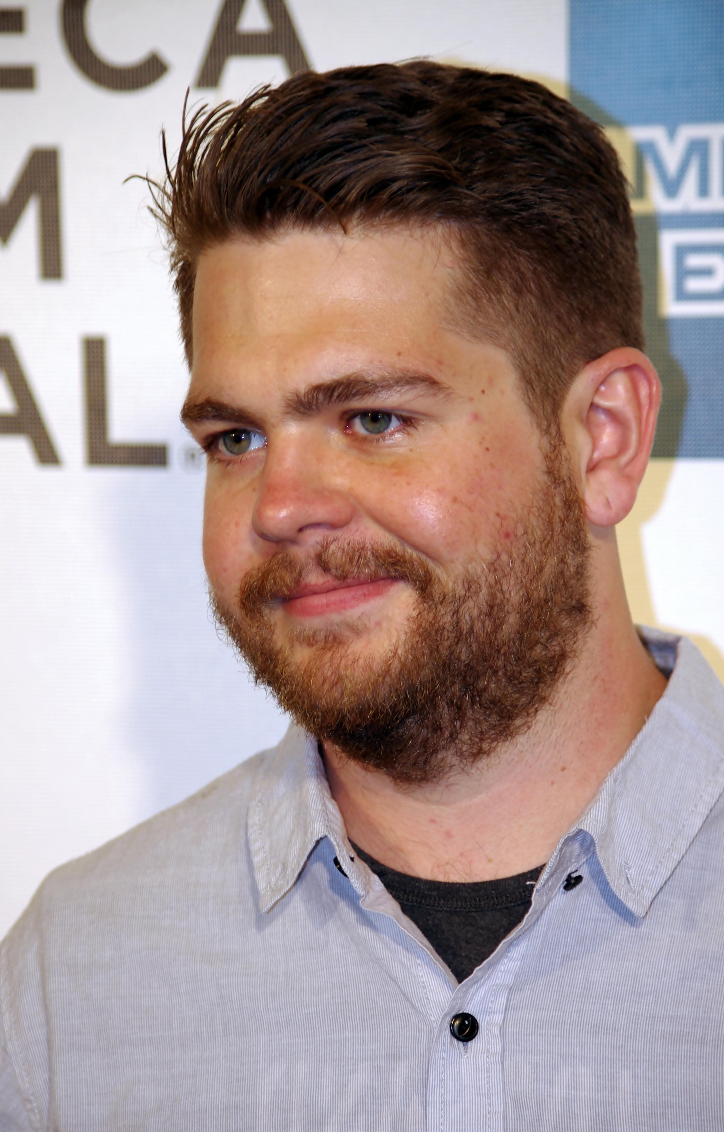 22 Celebrities Who Had Their Appendix Removed