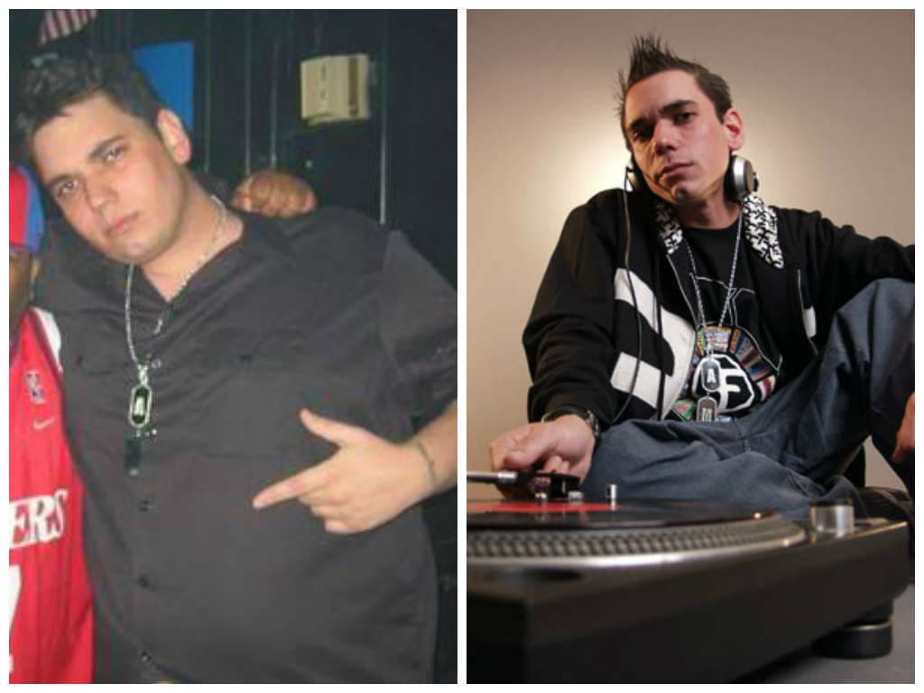 35+ Celebrities Who Had Weight Loss Surgery