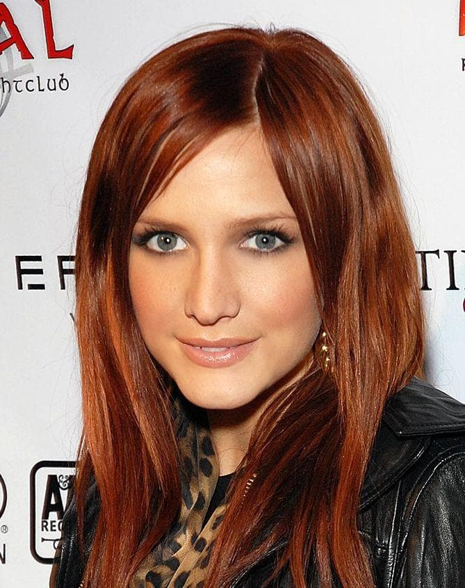 25+ Celebrities With Strabismus