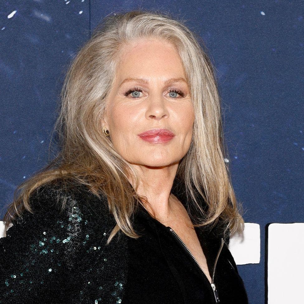 16 Celebrities With Overbites