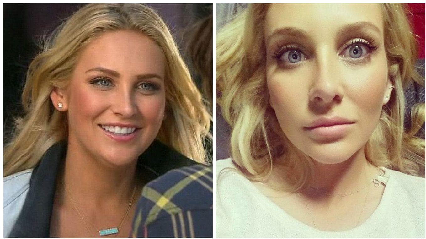 Stephanie Pratt Before And After Plastic Surgery