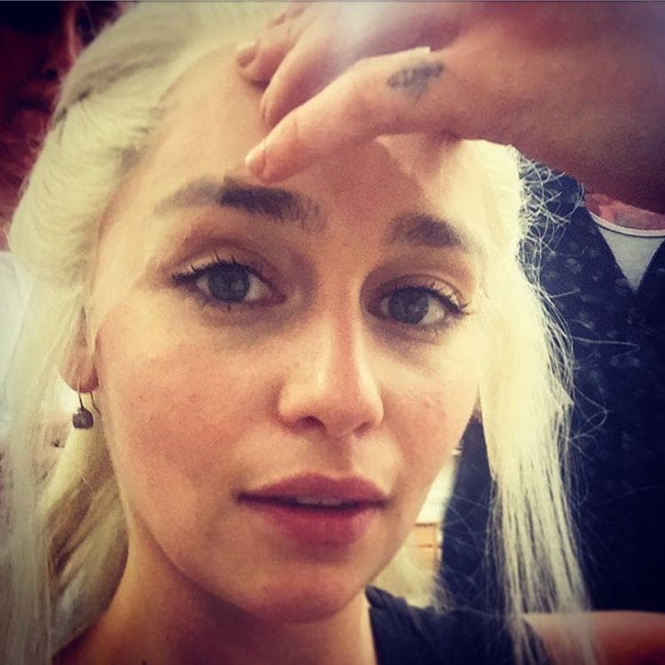 Celebrities Who Wear Wigs | Famous People With Hair Pieces