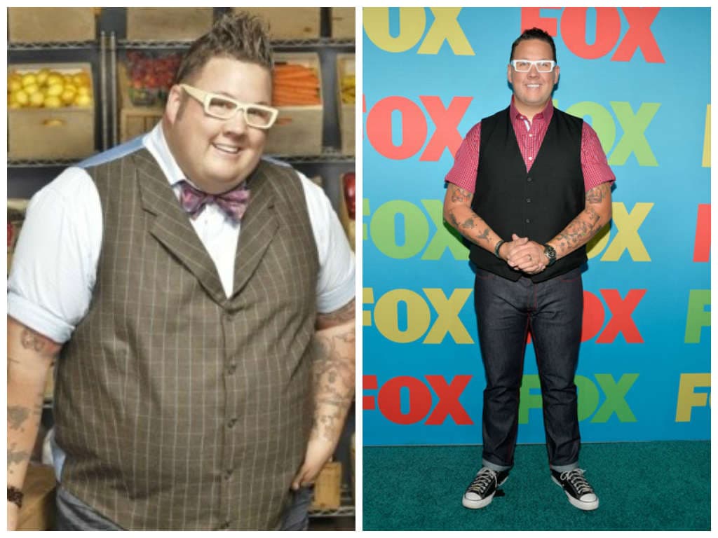 35+ Celebrities Who Had Weight Loss Surgery