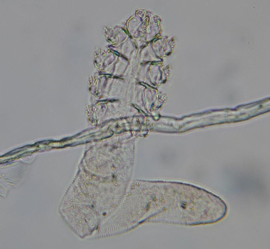 All Of The Flesh Eating Insects That Make Our Skin Crawl