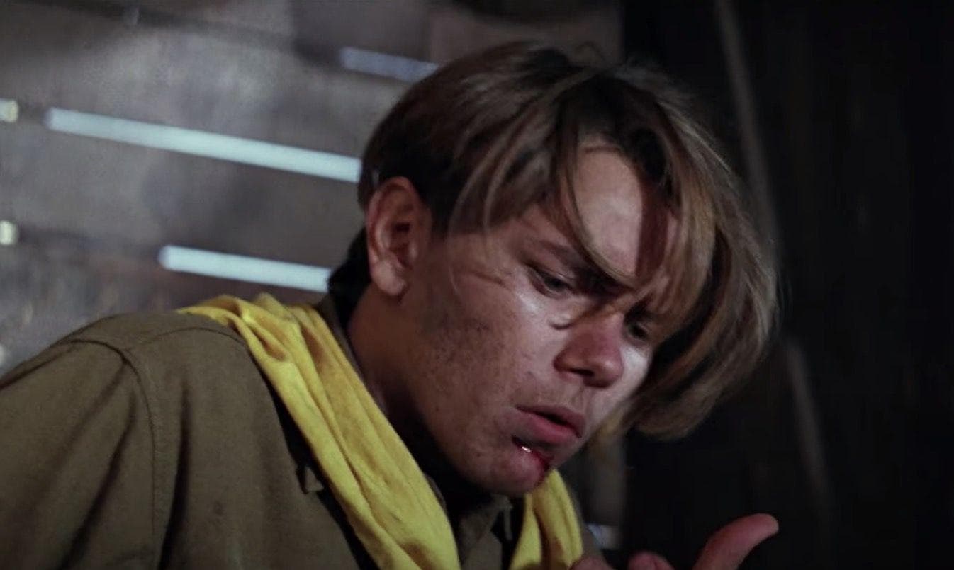 14 Times Real-World Injuries Were Written Into Movies