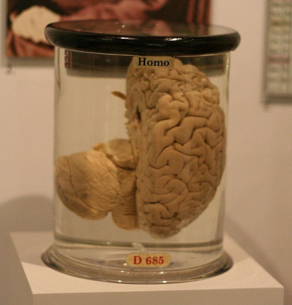 Preserved Bodies Of Famous People